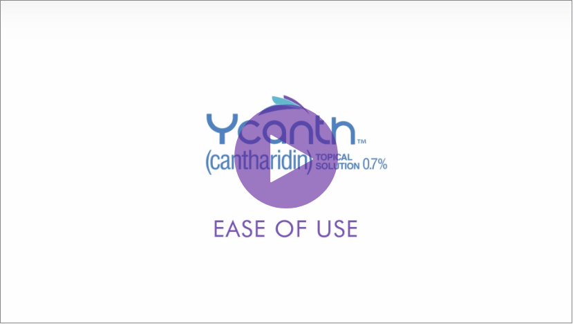 About YCANTH® (cantharidin) 0.7% topical solution